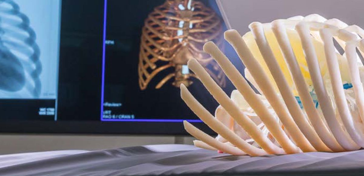 Creating Realistic Imaging Simulations with 3D Printed Phantoms