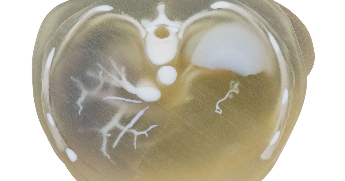 Stratasys Announces Radiopaque Material For Digital Anatomy 3D Printer