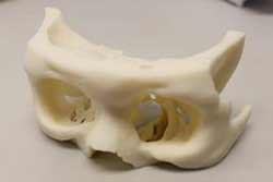 3D Printing Enables More Precise Surgical Implants for Eye Operations