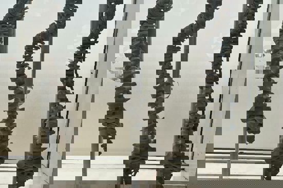 3D Printing Supports Treatment for Dorsal Scoliosis