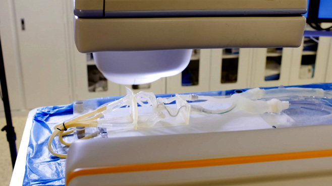 3D Vascular Models Improve Patient Care, Train Doctors and Test New Devices